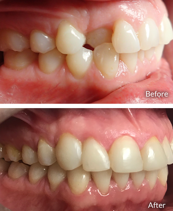 Our Smile Gallery | Dental Treatment Before and After Photos